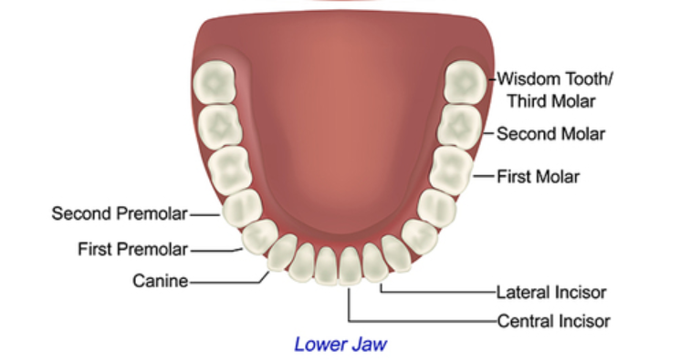 Wisdom Tooth, Impaction and Odontectomy – Dentaderm